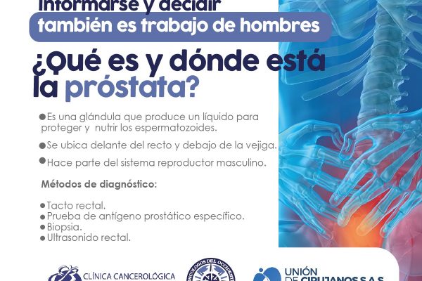 ¿Qué es y dónde está la próstata? • Oncólogos del Occidente S.A.S ...