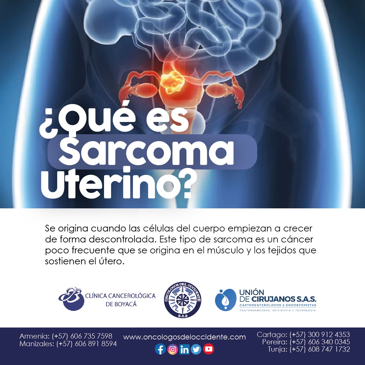 11 julio, 2022 • Oncólogos del Occidente S.A.S. | Zentria | Tratamientos de Cáncer en Armenia ...