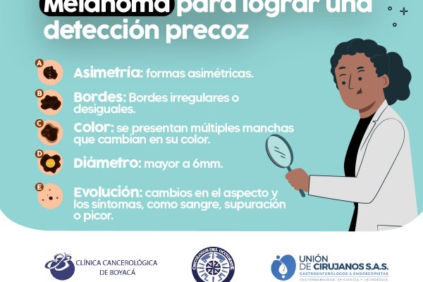 La regla del «ABCDE» del Melanoma para lograr una detección precoz ...